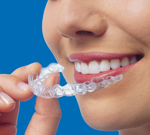 FREE 3D Scan for Invisalign Plus Outcome Simulation! - Mill Creek and ...