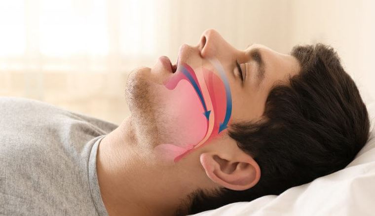 Stop Snoring and Sleep Better - Mill Creek and Northgate Dentist | All ...